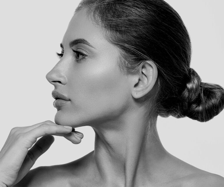 Lipo de mento (papada) - Dr Guilherme Cunha